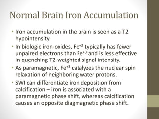 Neurodegeneretaion with Brain Iron Accumulation (NBIA) and Normal Brain ...