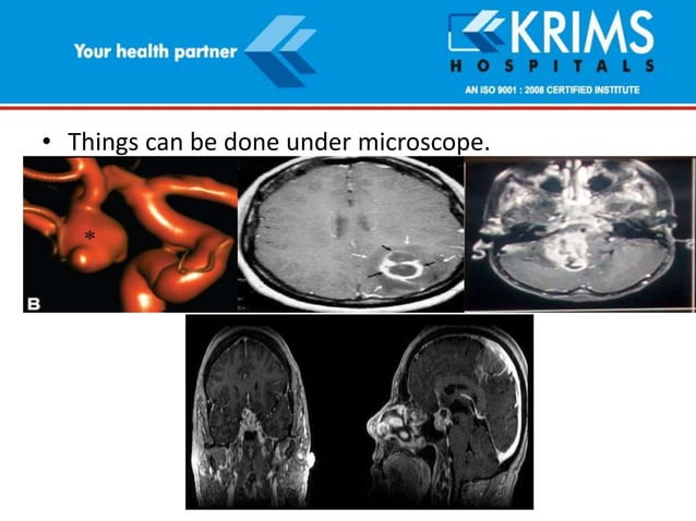 Neuro-Surgical Microscope | PPT