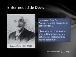 Neuromielitis óptica (enfermedad de devic).. | PPTX