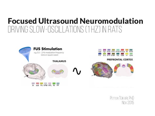 Focused Ultrasound Neuromodulation