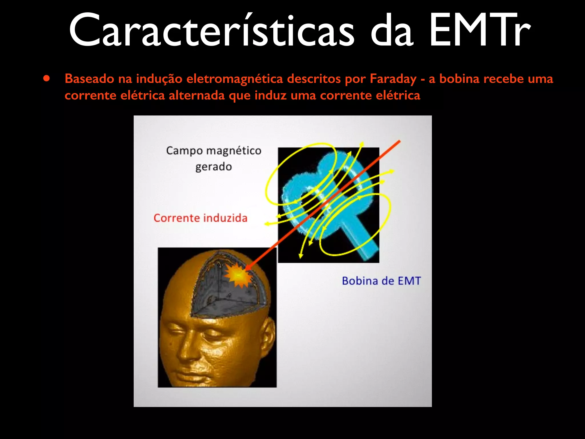 Neuromodulação Cerebral com Estimulação Magnética Transcraniana na Dor ...