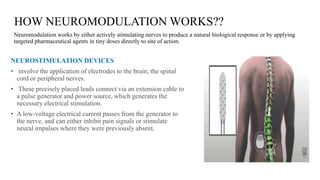 Neuromodulation | PPTX