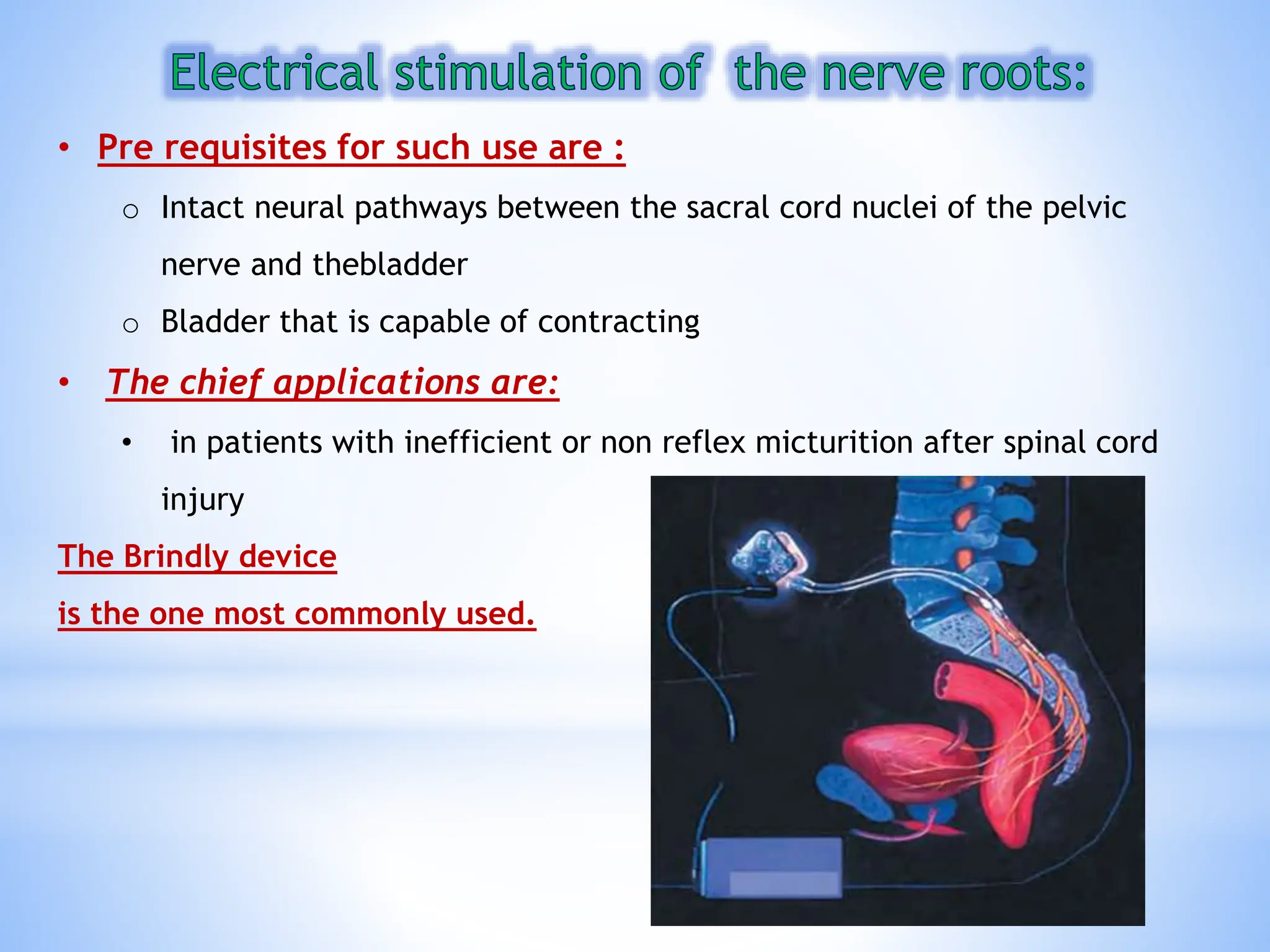 Neuromodulation in treatment of neurogenic bladder.pptx