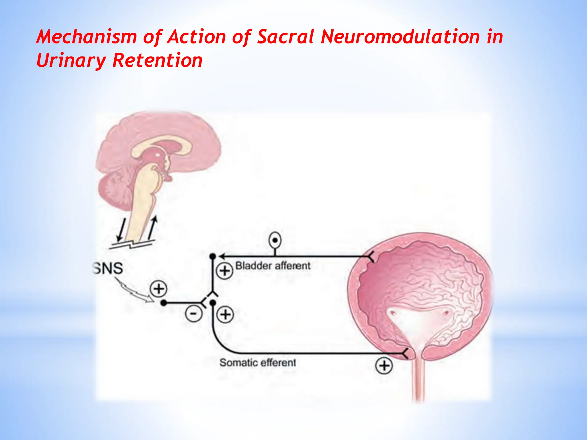 Neuromodulation in treatment of neurogenic bladder.pptx