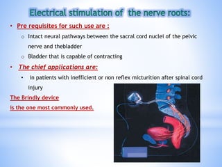 Neuromodulation in treatment of neurogenic bladder.pptx