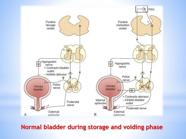 Neuromodulation in treatment of neurogenic bladder.pptx