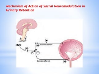 Neuromodulation in treatment of neurogenic bladder.pptx