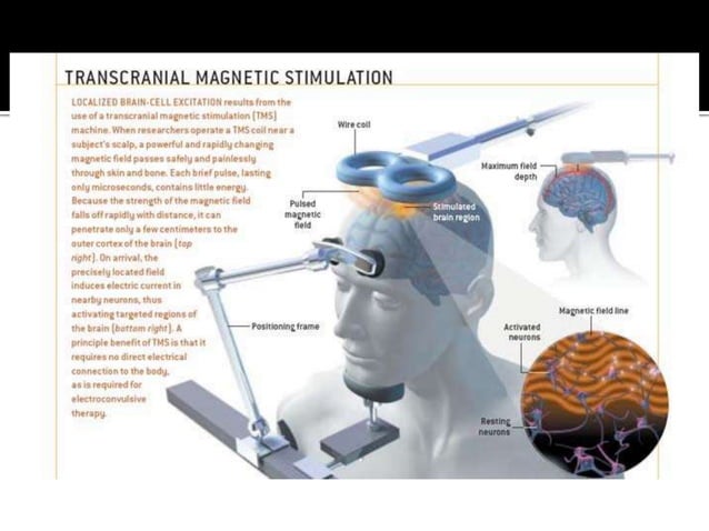Neuromodulation in psychiatry. | PPTX | Brain and Nervous System ...