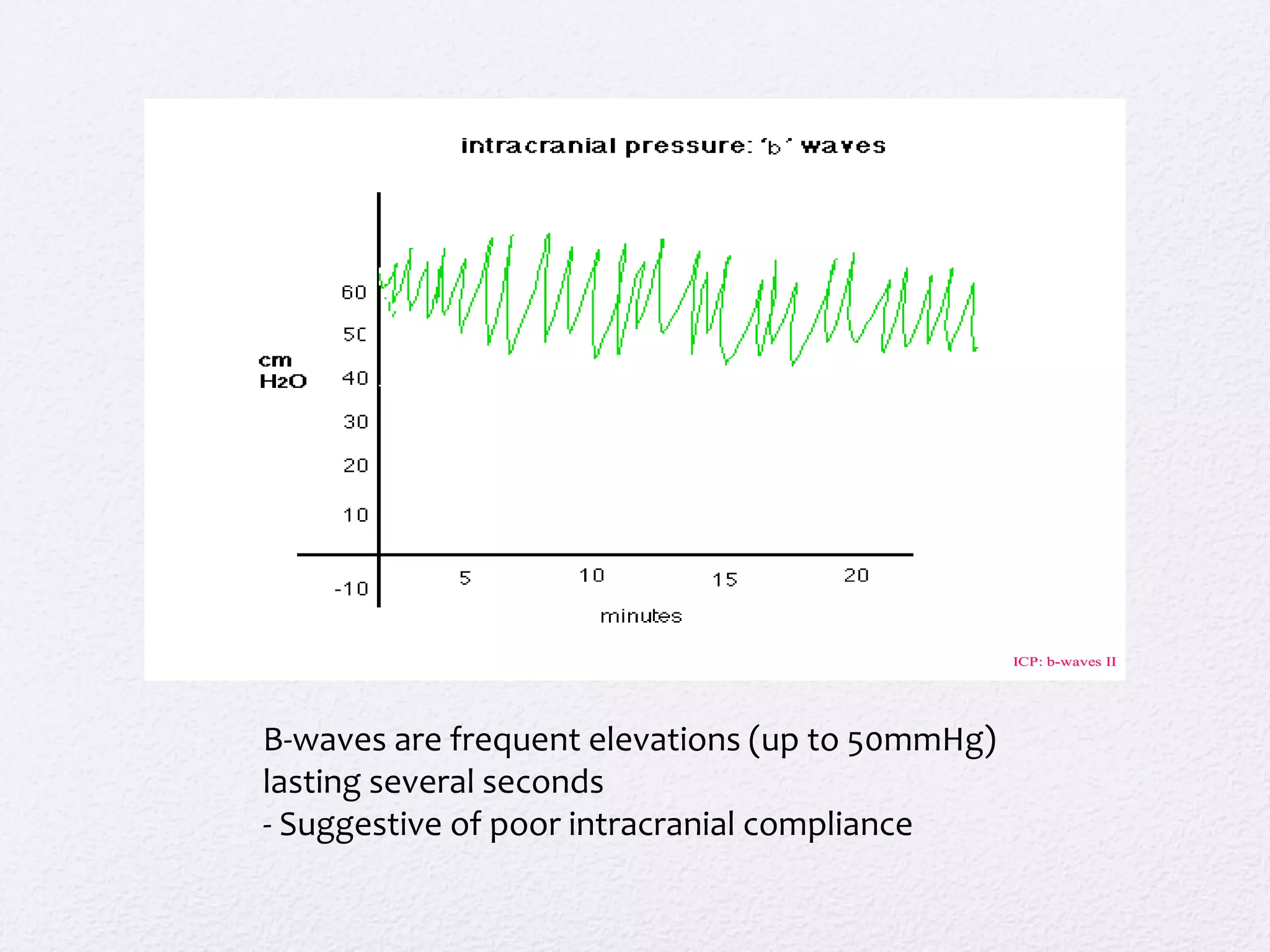Neuromonitoring and Cerebral Protection Strategies | PPT