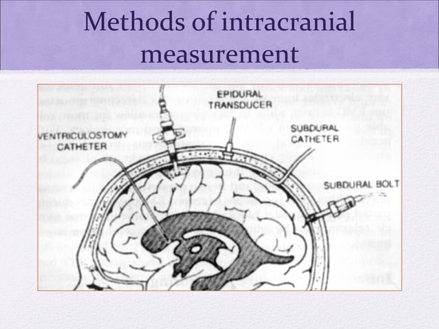 Neuromonitoring and Cerebral Protection Strategies | PPT | First Aid ...