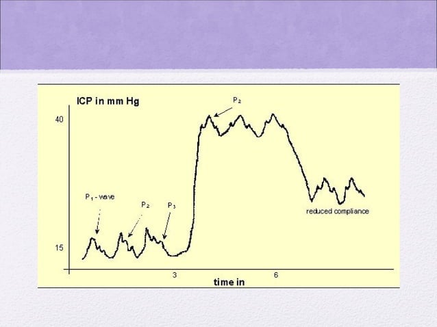 Neuromonitoring and Cerebral Protection Strategies | PPT | First Aid ...