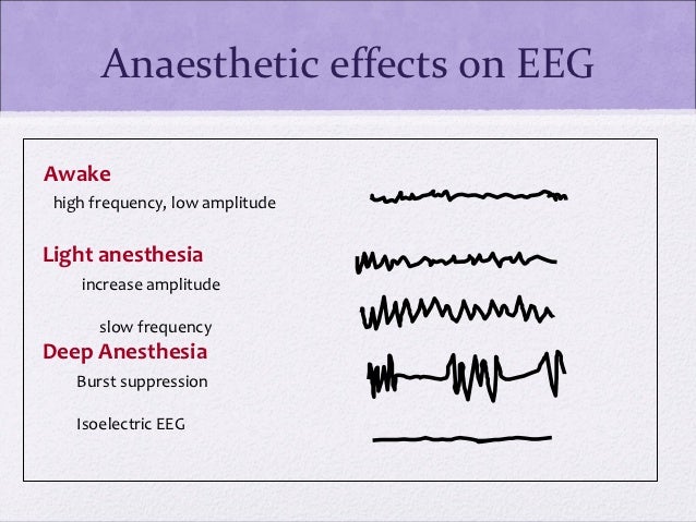 Neuromonitoring and Cerebral Protection Strategies