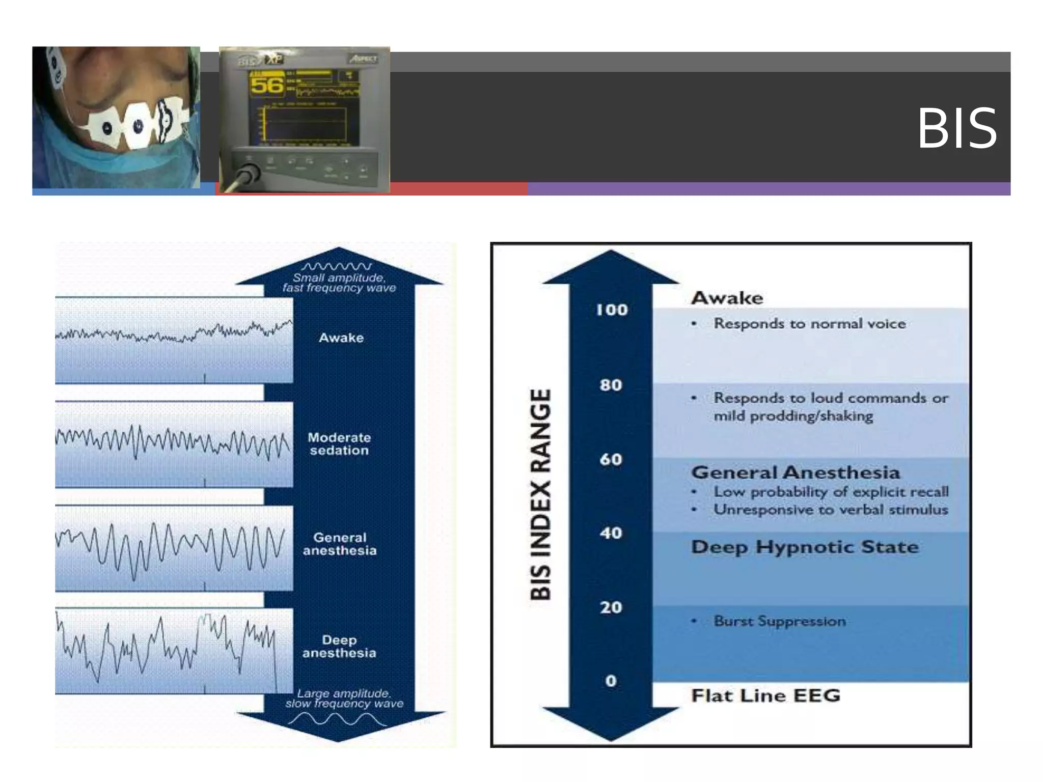 Neuromonitoring in anesthesia | PPTX