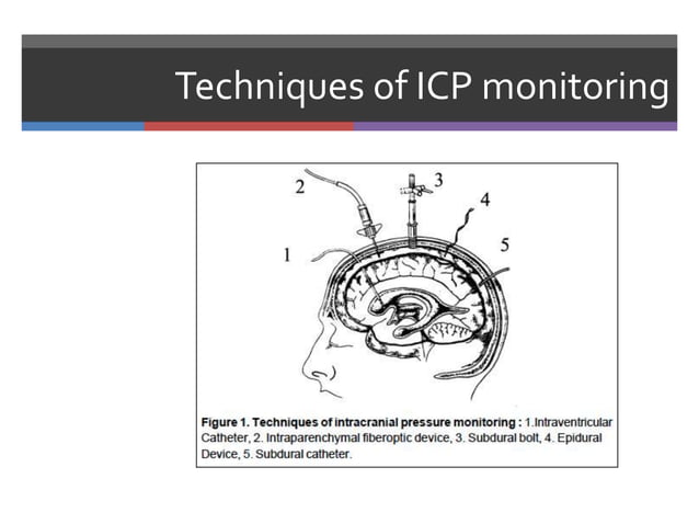 Neuromonitoring in anesthesia | PPTX | Brain and Nervous System ...