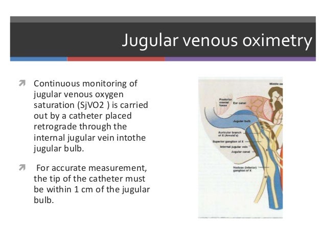 Neuromonitoring in anesthesia