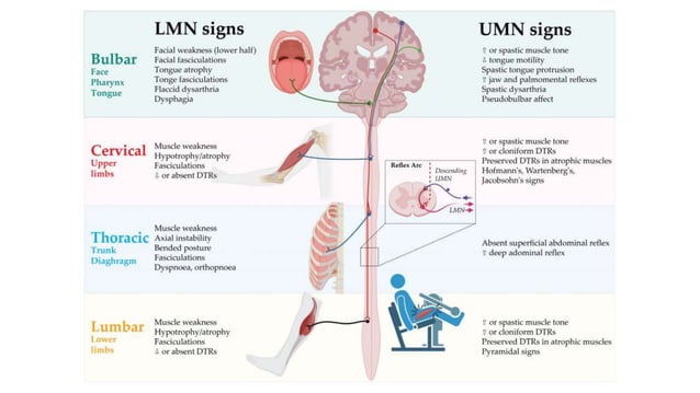 Neuromuscular UMN vs LMN teori Basic.pptx