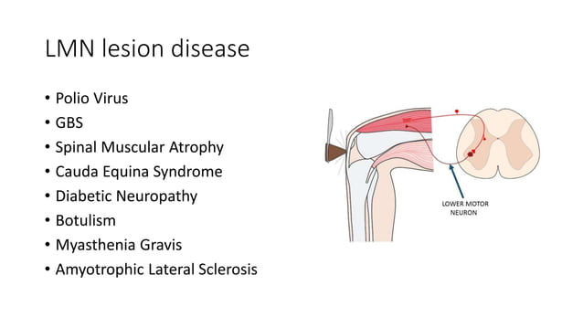 Neuromuscular UMN vs LMN teori Basic.pptx