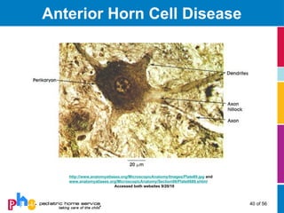 neuromusculardiseases.pptxxxxxxxxxxxxxxx | PPTX