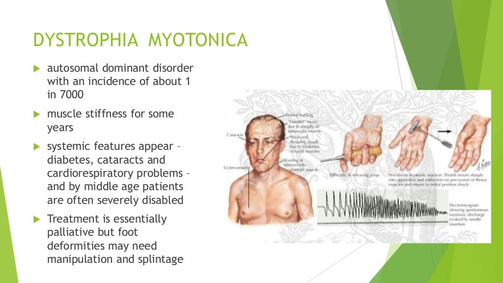 Neuromuscular disorder