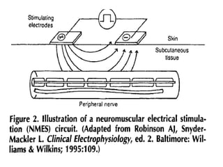 Neuromuscular electrical stimulation | PPTX