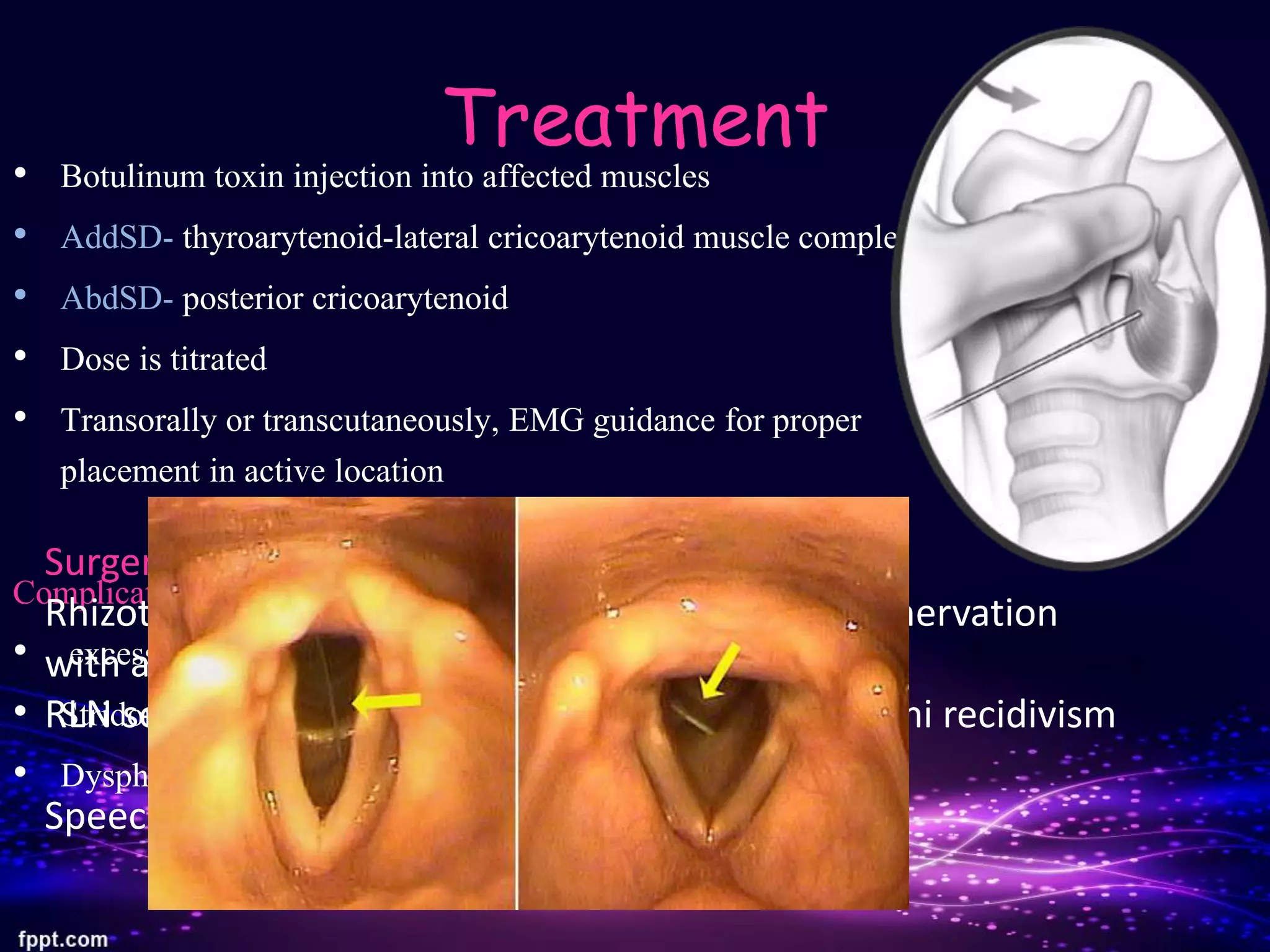 Neuromuscular junction | PPTX