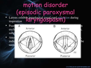 Neuromuscular junction | PPTX