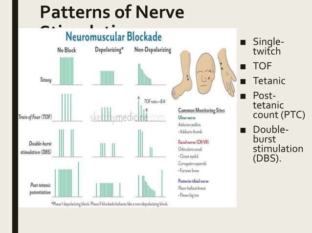 Neuromuscular monitoring | PPT