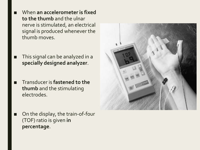 Neuromuscular monitoring | PPT