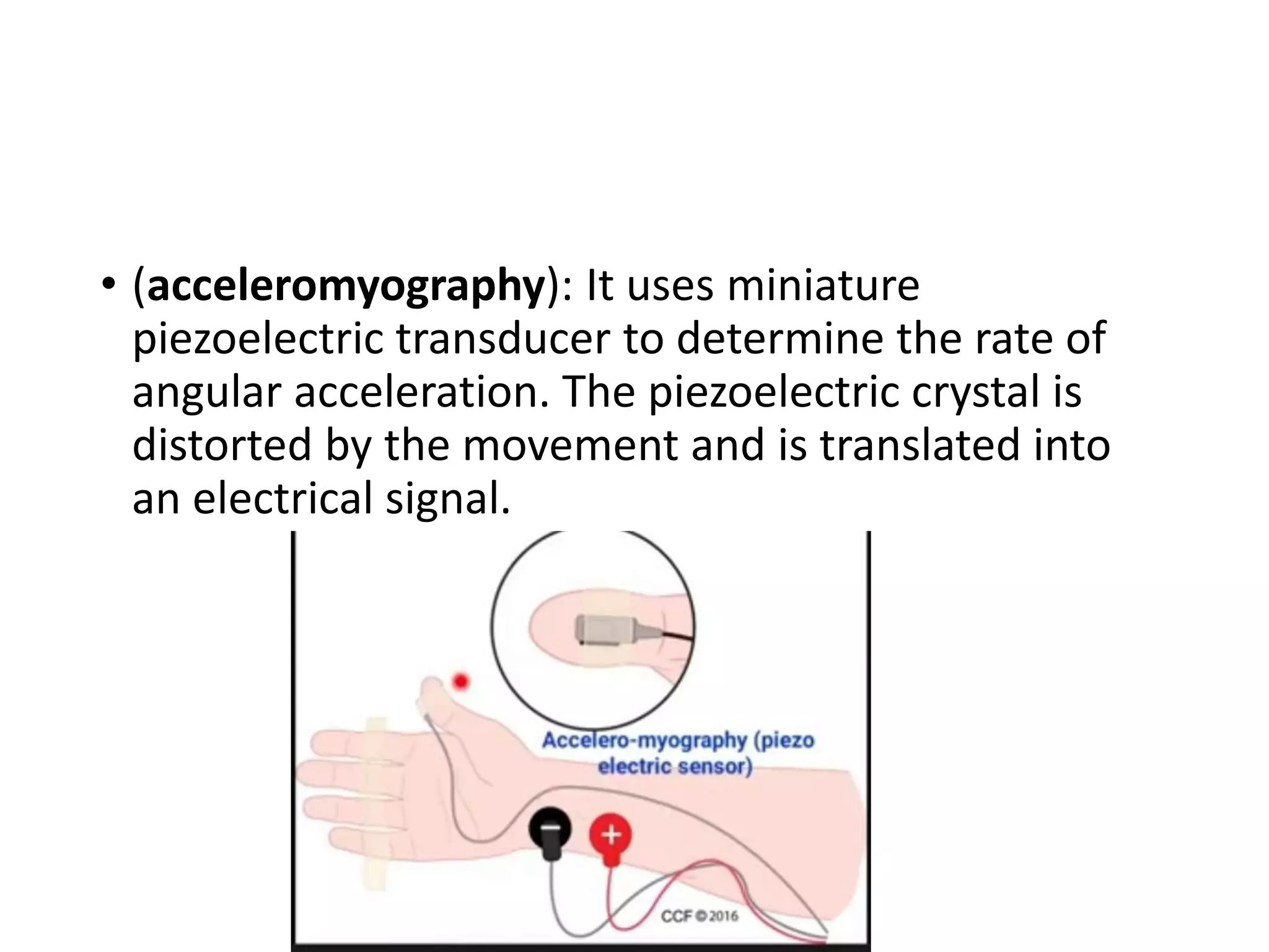 Neuromuscular monitoring | PPT