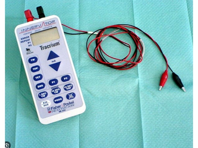 Neuromuscular monitoring | PPT