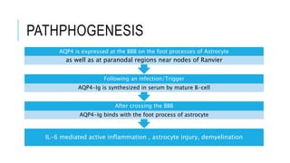 Neuromyelitis optica | PPTX