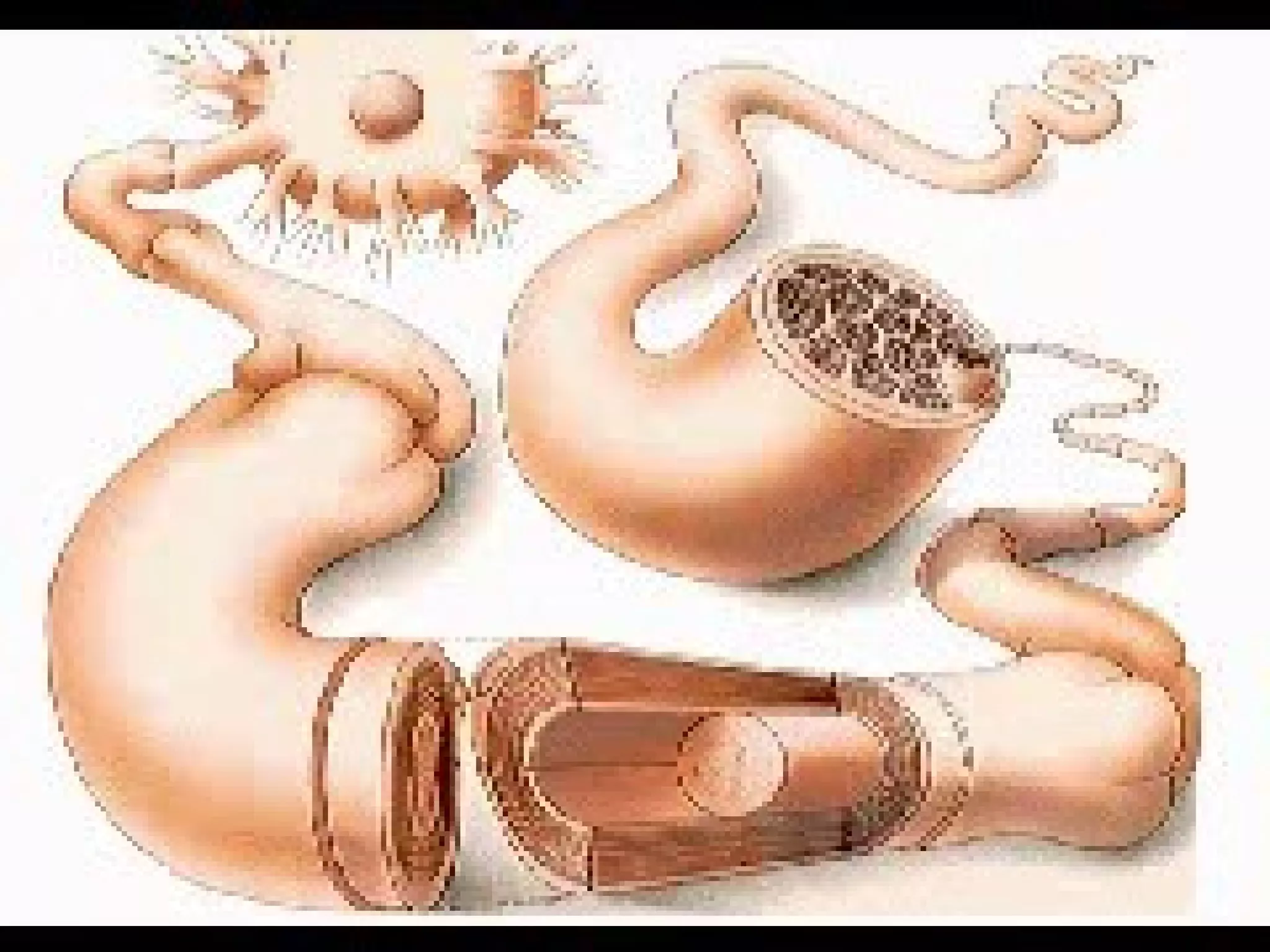 peripheral nerve lesions | PPT