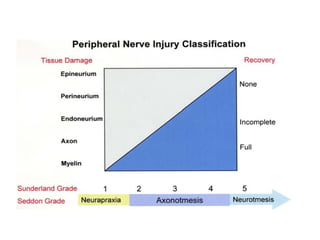 peripheral nerve lesions | PPT
