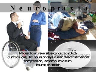 Neuronal injuries | PPT