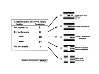 Neuronal injuries | PPT