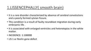 NEURONAL MIGRATION DISORDER (2) | PPTX