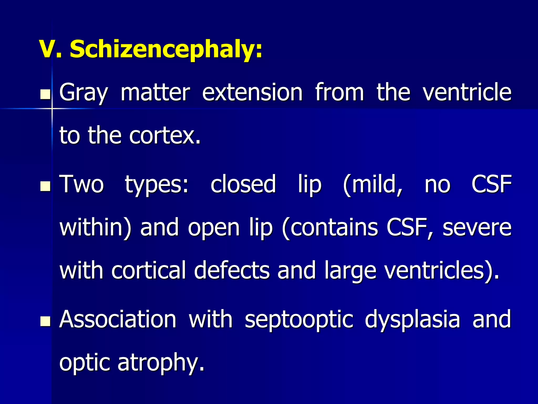 Neuronal migration disorders | PDF