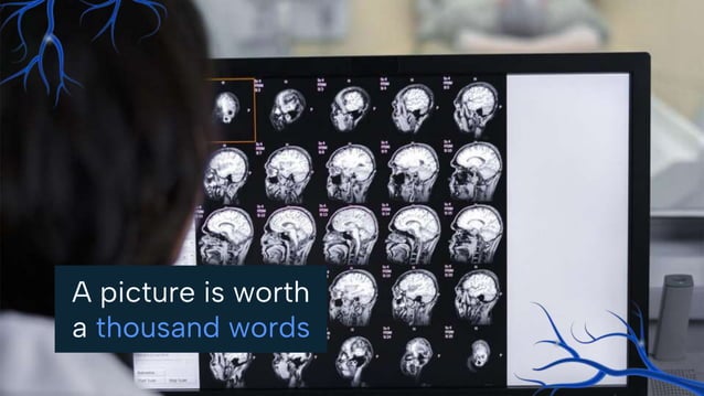 Neuronal Synapse Case Report by Slidesgo.pptx