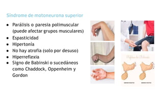 neurona motora superior e inferior.pptx