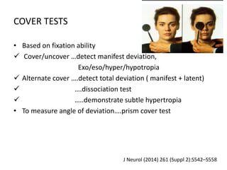 Neuro ophthalmology Basics | PPTX