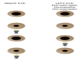 Neuro ophthalmology Basics | PPTX