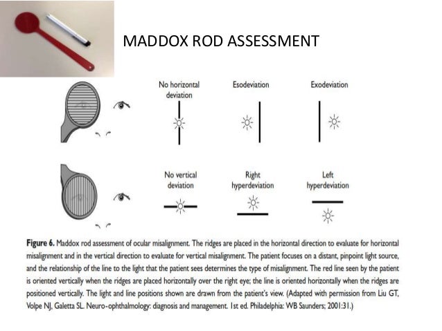 Neuro ophthalmology Basics