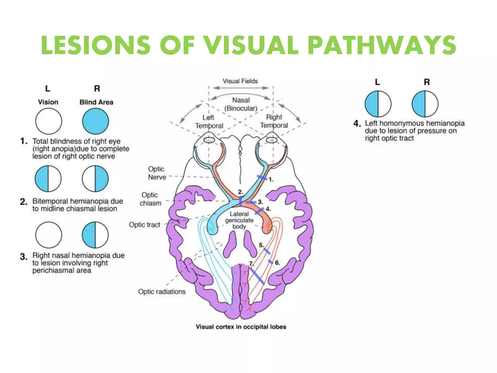 NEURO-OPHTHALMOLOGY | PPTX
