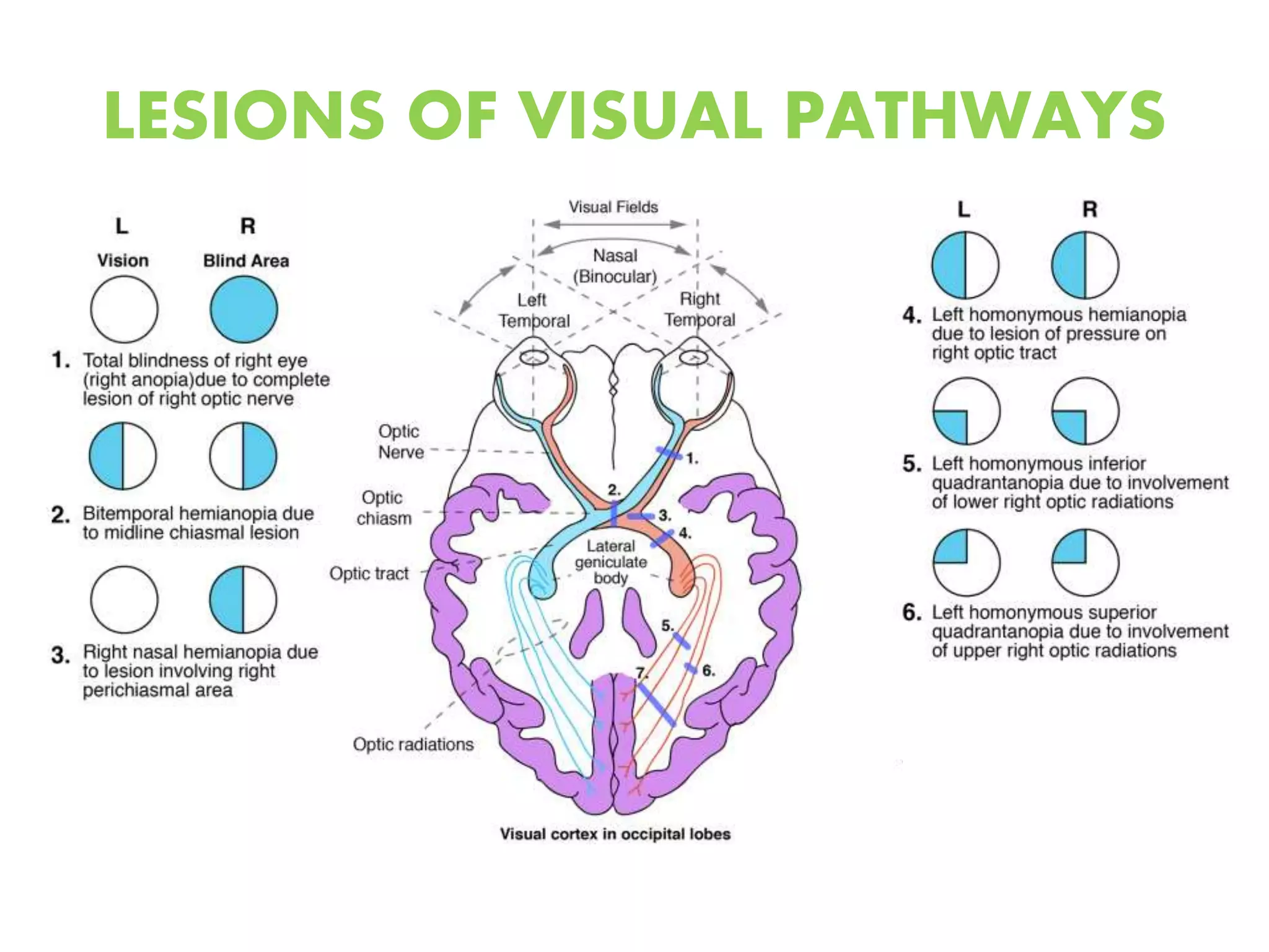 NEURO-OPHTHALMOLOGY | PPTX