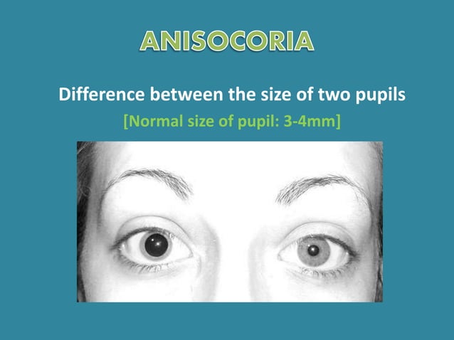 NEURO-OPHTHALMOLOGY | PPTX