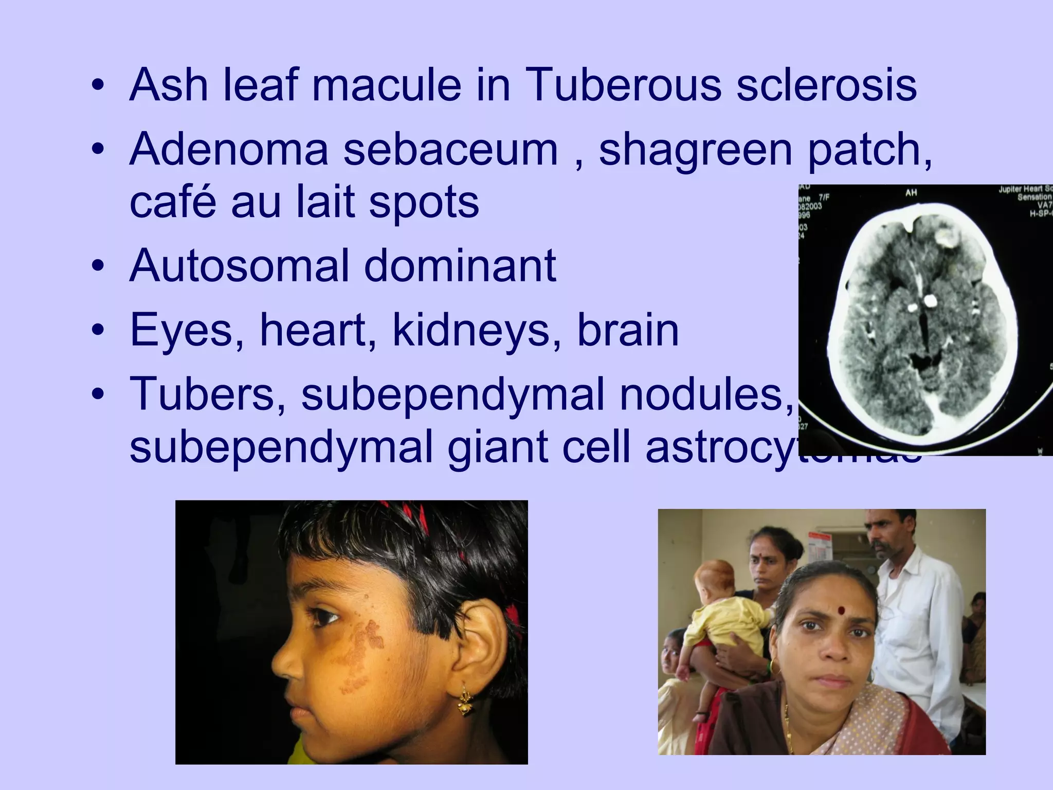 Pediatric Neurology OSCE (PG CME -Wadia) | PPT