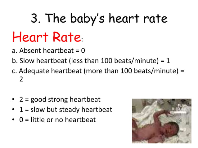 neuro pediatric assessment proforma.ppsx