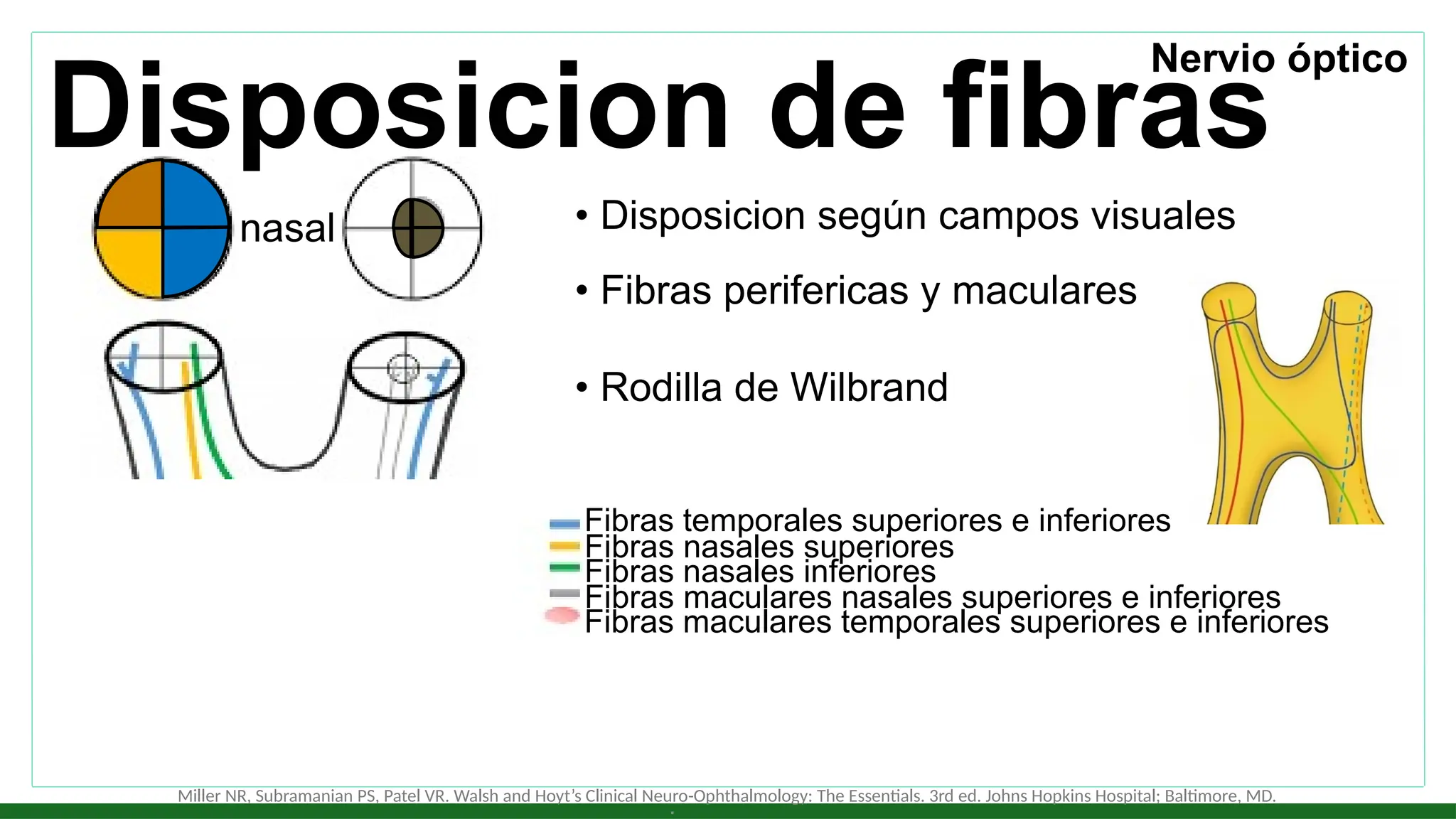 Neuropatía óptica traumática (Nervio óptico, defecto pupilar aferente ...