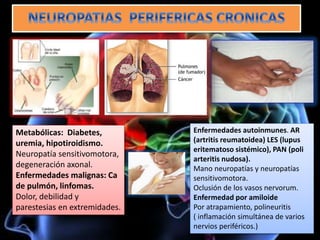 Neuropatías periféricas seminario | PPTX