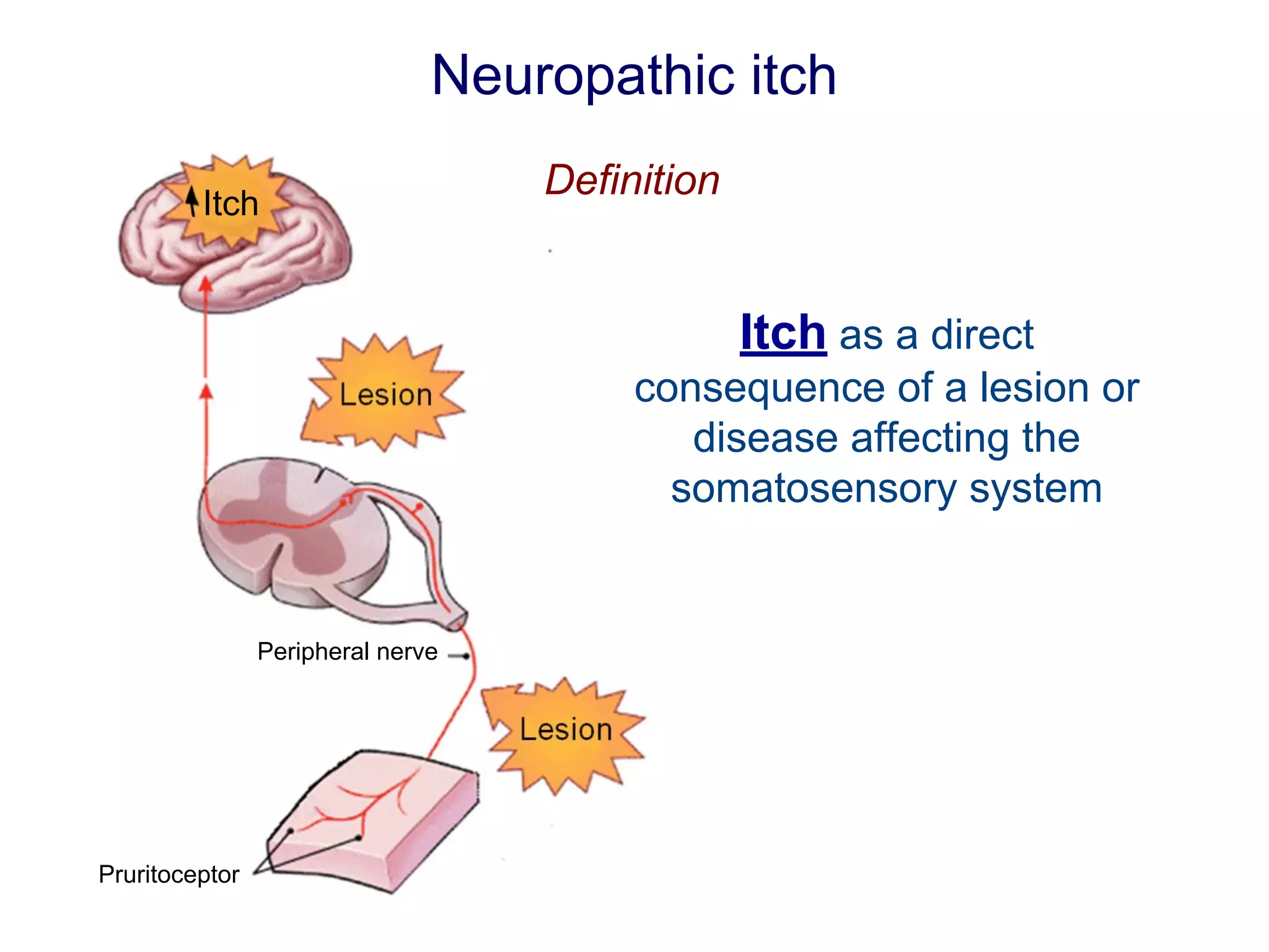 Neuropathic itch (2014) | PDF | Brain and Nervous System Disorders ...